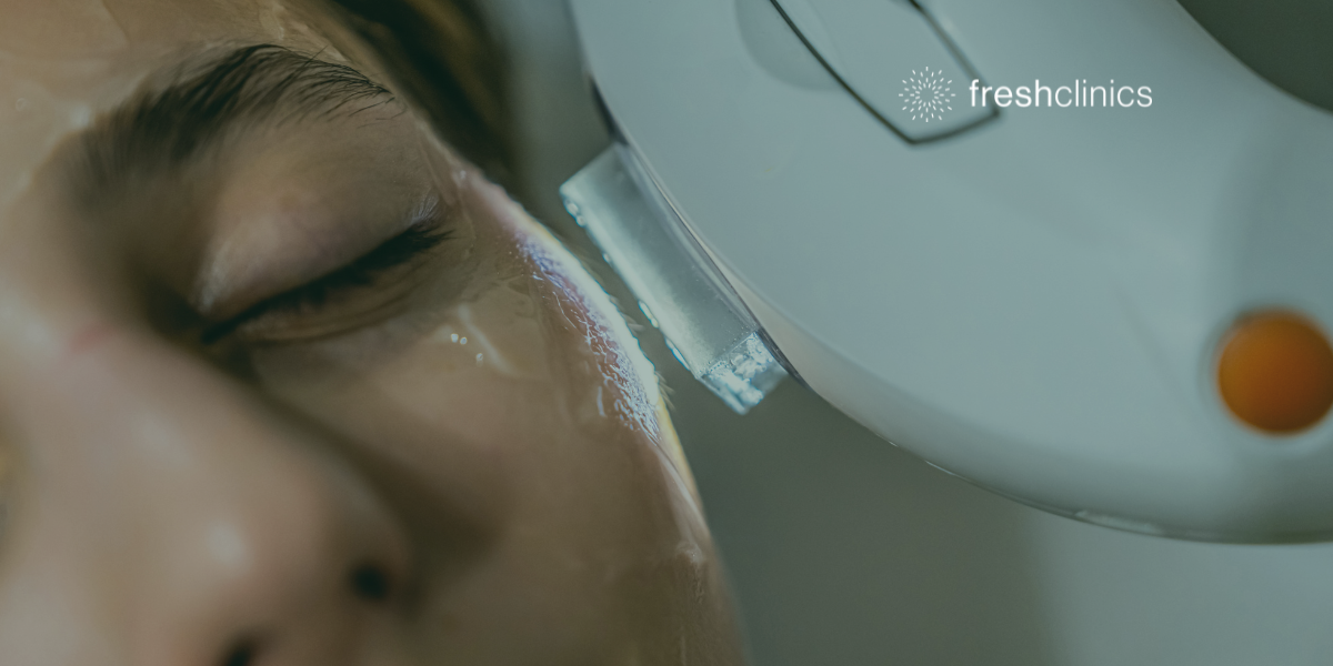 Mastering Laser and IPL Devices